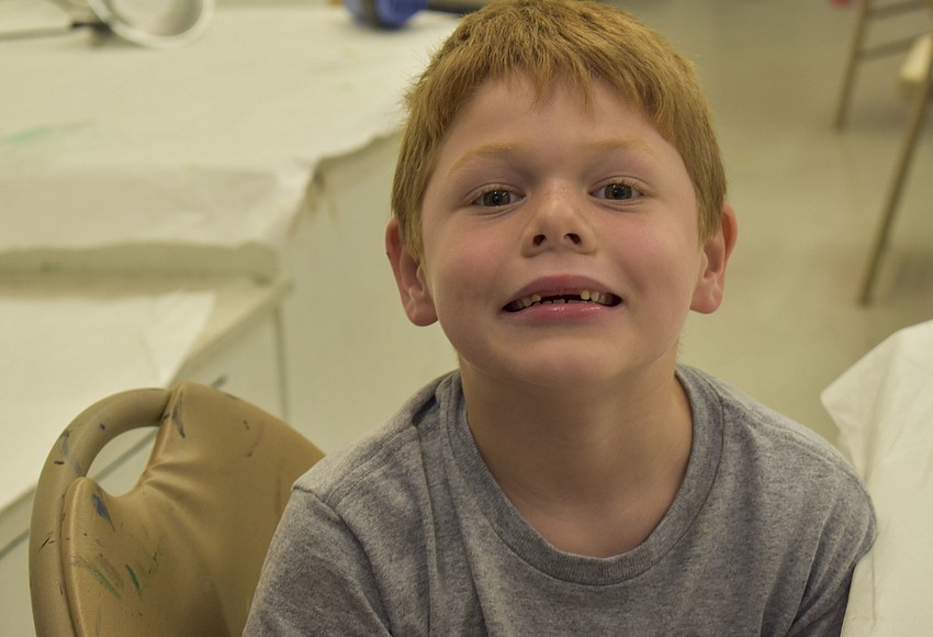 Your Observer | Photo - Jake Johnson shows off is missing teeth.